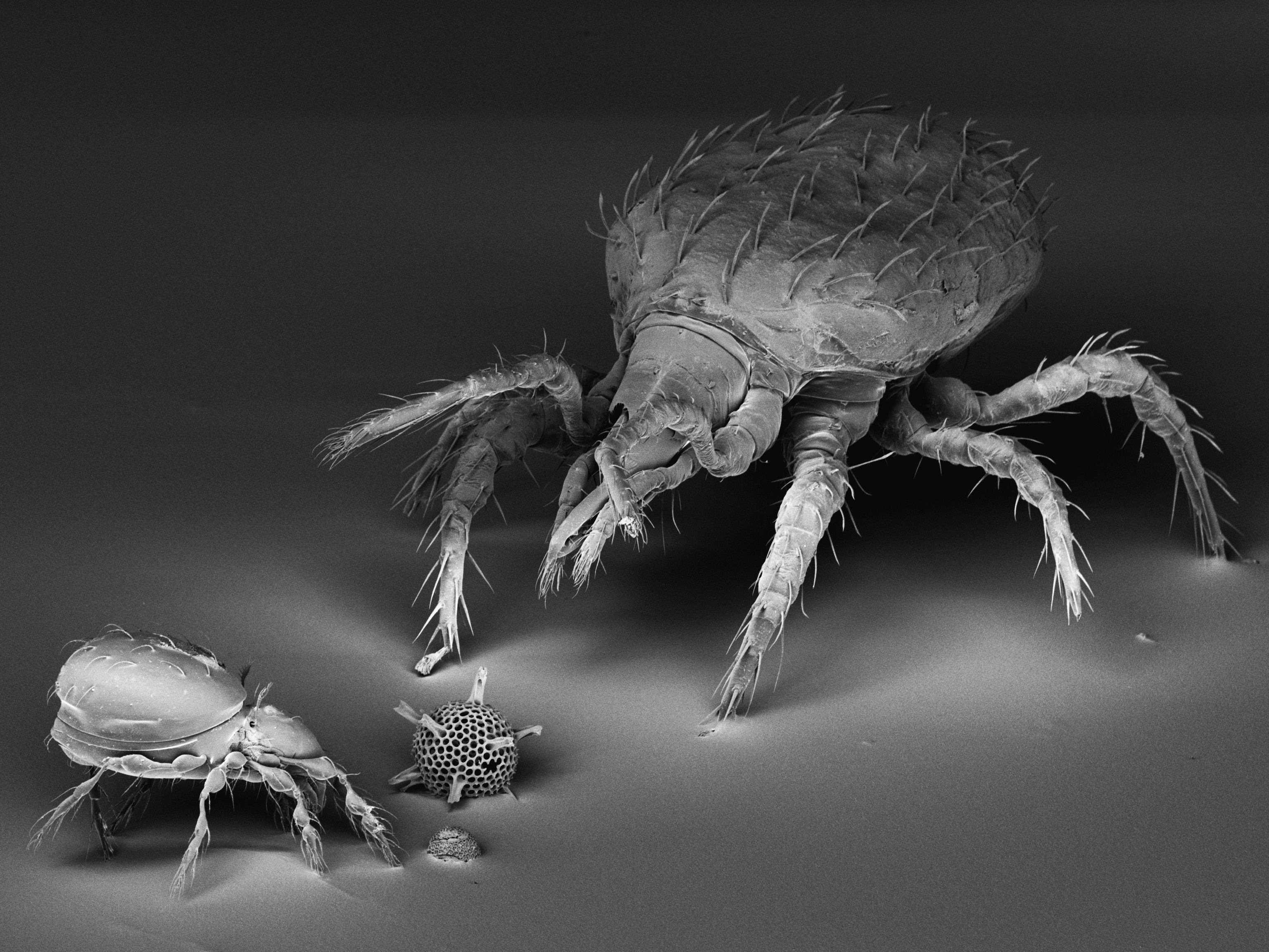Dust Mite Electron Microscope